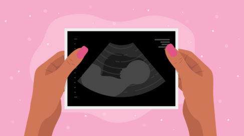 DES and Birth Defects - symptoms, causes, therapy