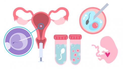 IVF After Menopause - Is It Possible?
